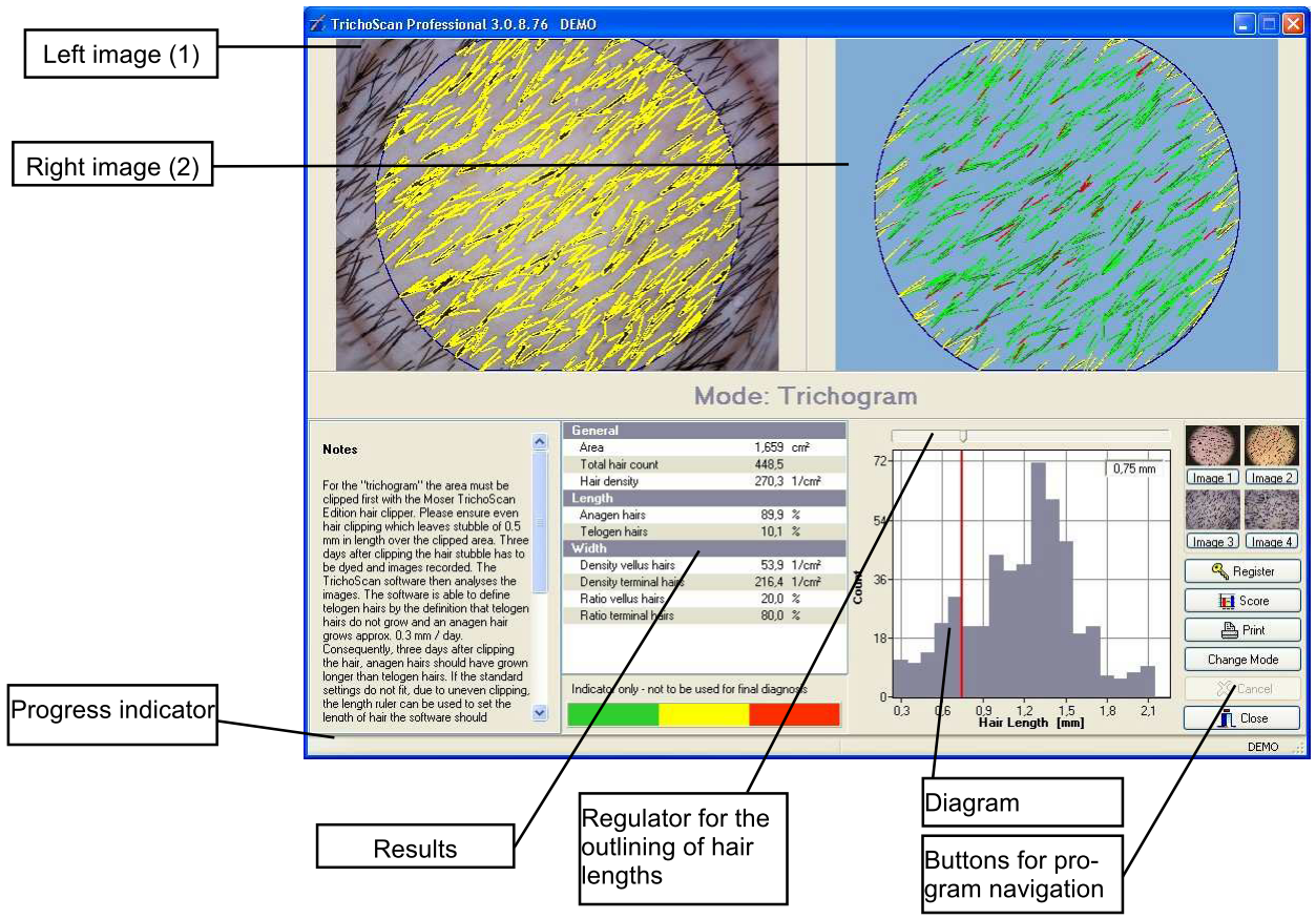 Trichoscan Analysis - Pilogics LTD